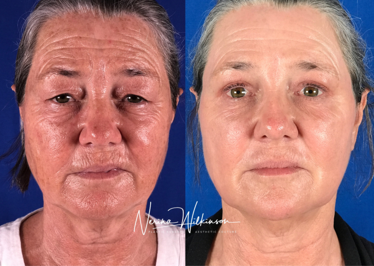 THE MIRACLE OF STEM CELLS - Dr Nerina Wilkinson + Associates